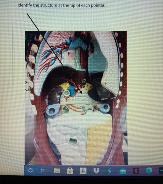 Solved Identify the structure at the tip of each pointer. a | Chegg.com