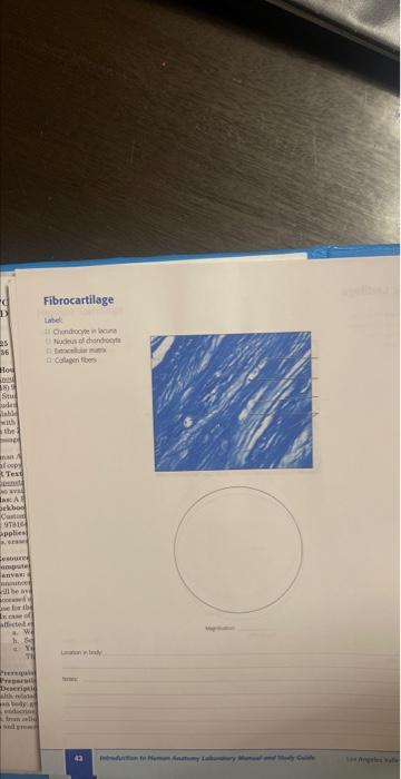 Solved Fibrocartilage tarted: it Oindoove n wore a coligen | Chegg.com