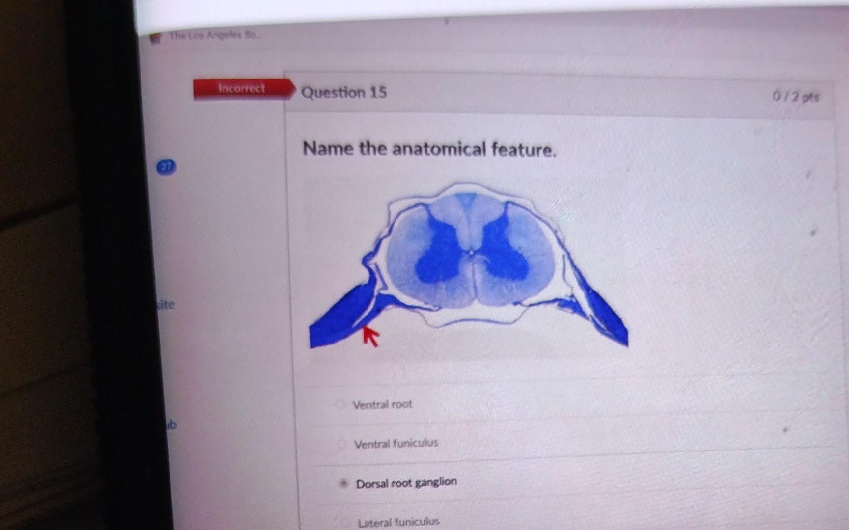 Name the anatomical feature. Ventral root Ventral | Chegg.com