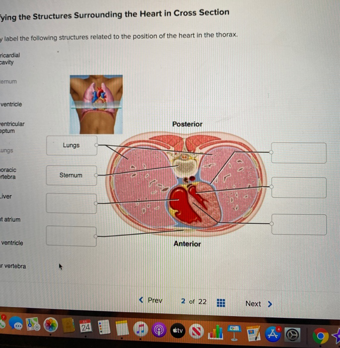 Solved Eying the Structures Surrounding the Heart in Cross | Chegg.com