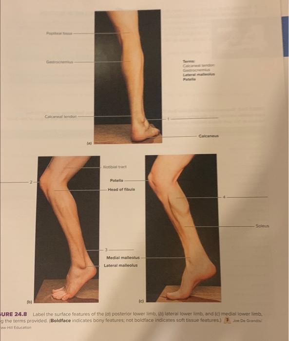 Terms: Lateral malleolus Medial malleolus Patella | Chegg.com