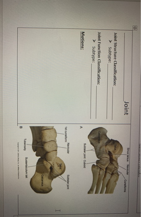 Solved Joint Sinus tarsus Naviour Cuneiforme Joint Structure | Chegg.com