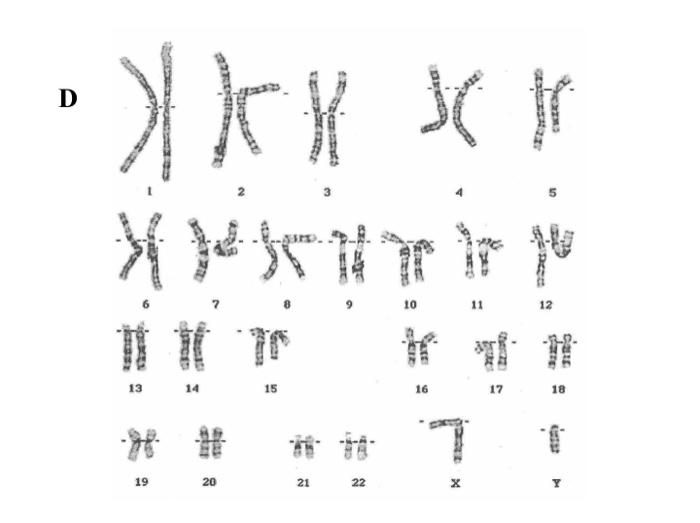 Solved Karyotype Lab Chromosome structure and chromosome | Chegg.com