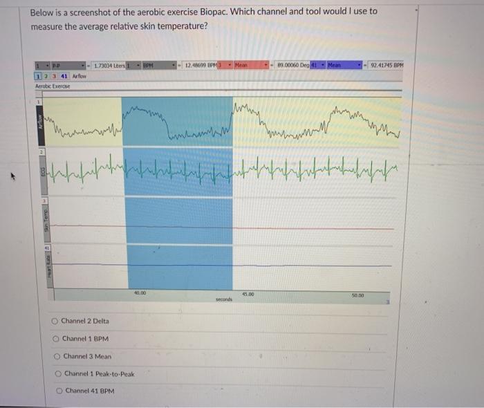 Solved A patient has a heart rate of 87 beats per minute and | Chegg.com