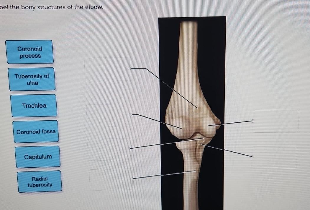 Solved bel the bony structures of the elbow. | Chegg.com