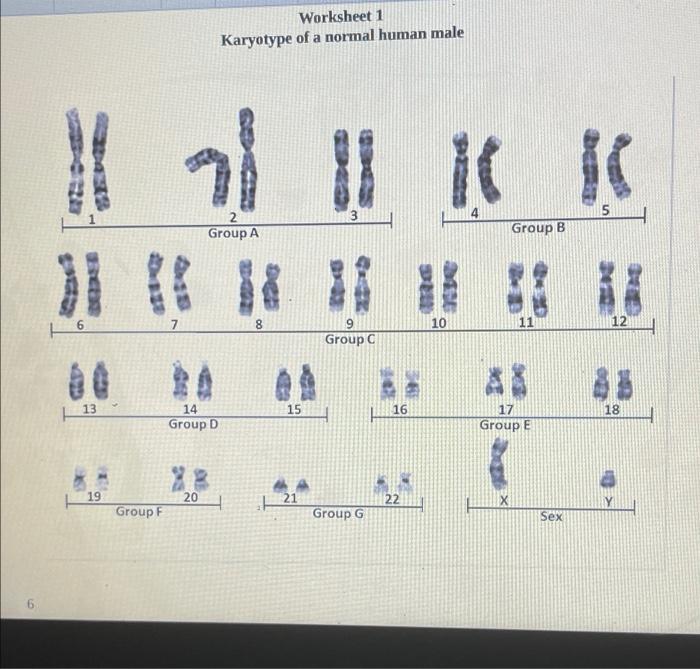 Solved Worksheet 1 Karyotype of a normal human maleTask 2 To | Chegg.com