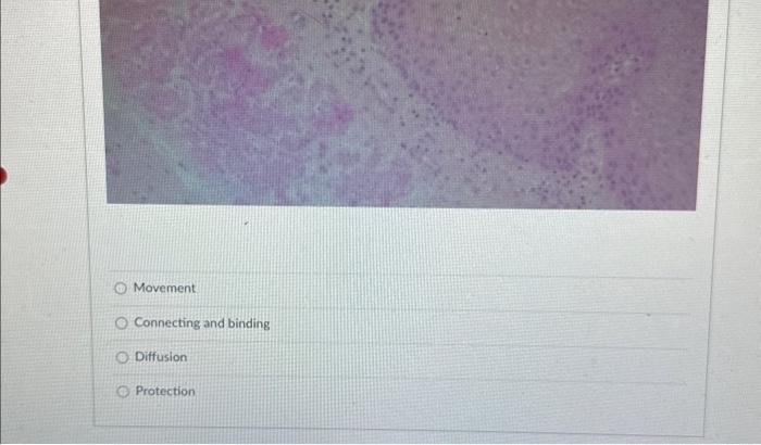 Solved One function of this tissue is: Movement Connecting | Chegg.com