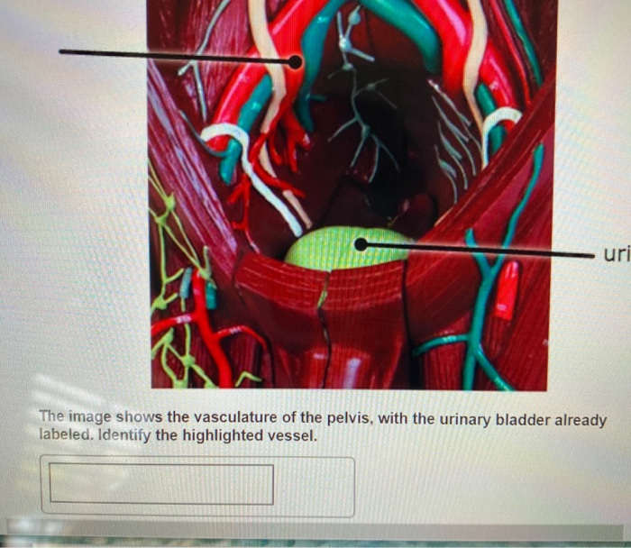 Solved uri The image shows the vasculature of the pelvis, | Chegg.com