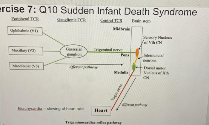 Solved 10 Using The Proposed Pathway Predict Whether Sids
