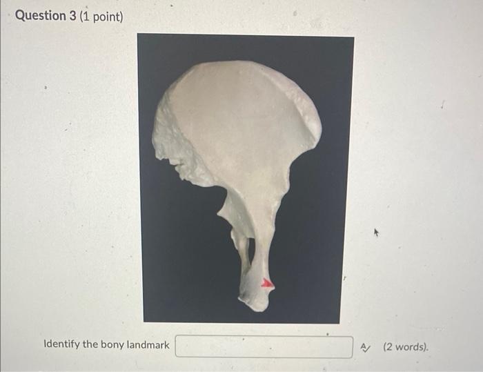 Solved Question 3 (1 point) Identify the bony landmark A (2 | Chegg.com