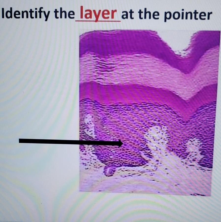Solved Identify the layer at the pointer | Chegg.com