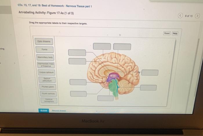 Solved (Ex. 15, 17, and 19: Best of Homework - Nervous | Chegg.com