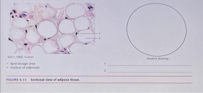 Solved Student drawing 400X, H&E, human • lipid storage area | Chegg.com