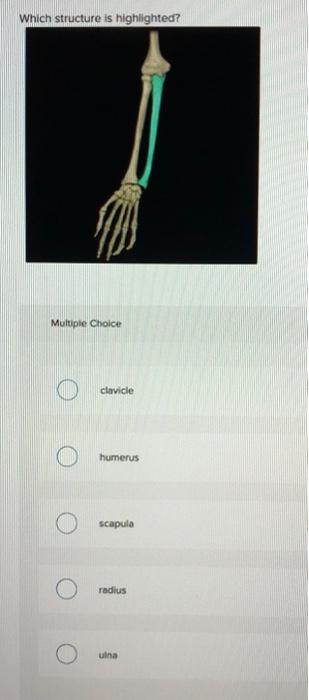 Solved Which structure is highlighted? Multiple Choice O | Chegg.com