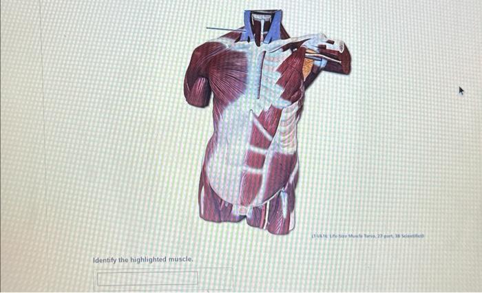 Solved Identify the highlighted muscle. | Chegg.com