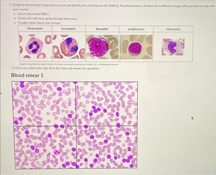 Solved 1. Using the blood smear image below count and | Chegg.com