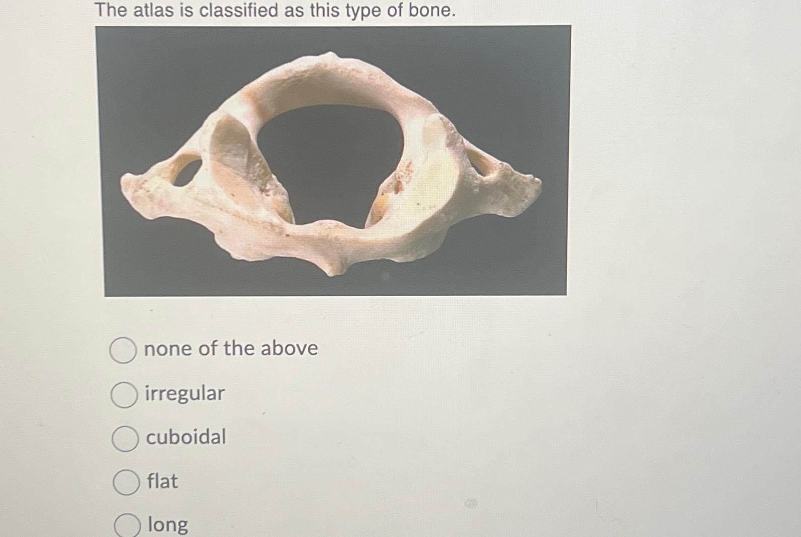 Solved The atlas is classified as this type of bone.none of | Chegg.com