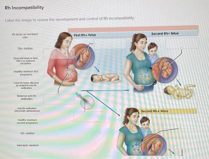 Solved Rh Incompatibility Label the image to review the | Chegg.com