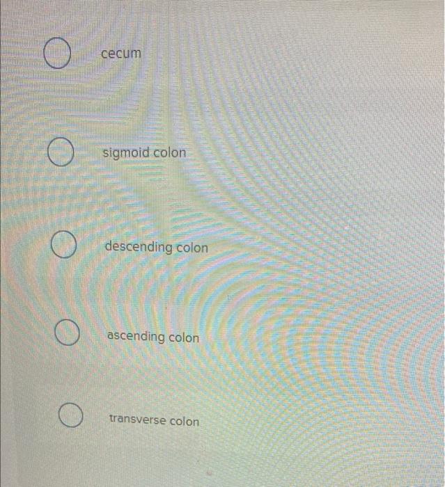 Solved Which structure is highlighted? cecum O sigmoid | Chegg.com