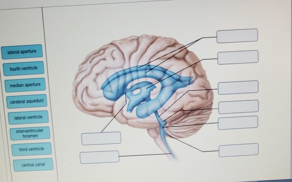 Solved lateral aperture fourth ventride median aperture II | Chegg.com