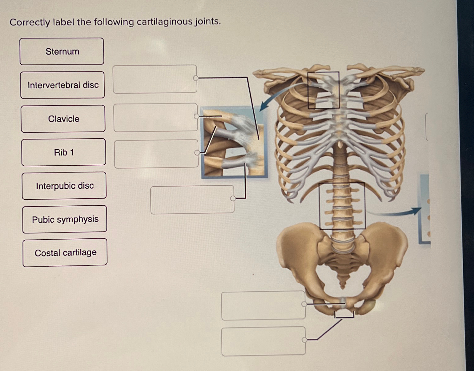 Solved Correctly label the following cartilaginous | Chegg.com