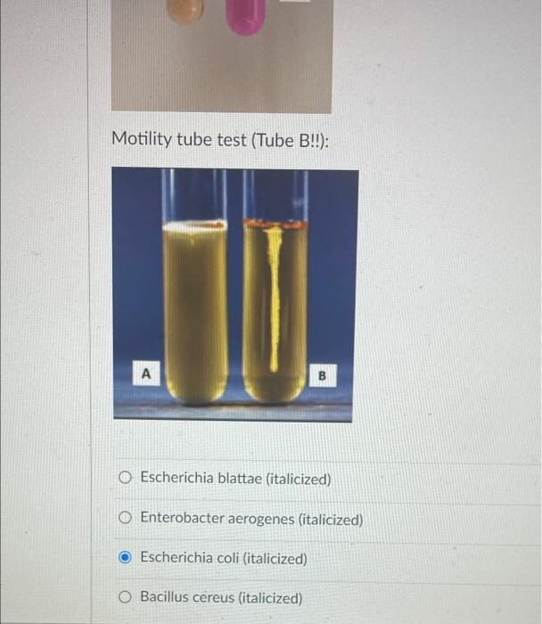 Enterobacter Aerogenes Motility Test