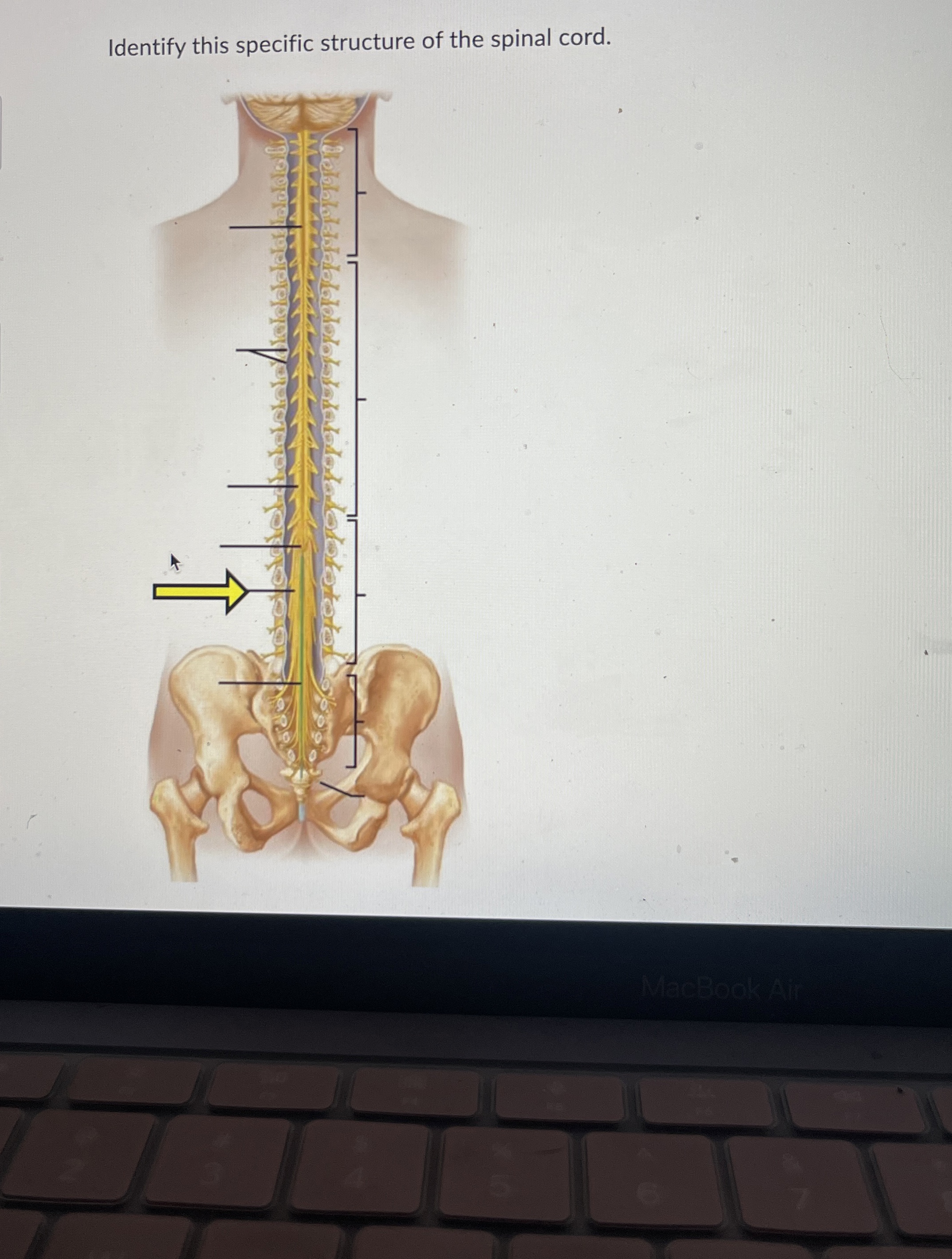 Solved Identify this specific structure of the spinal cord. | Chegg.com