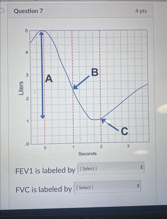 Solved FEV1 is labeled by FVC is labeled by | Chegg.com