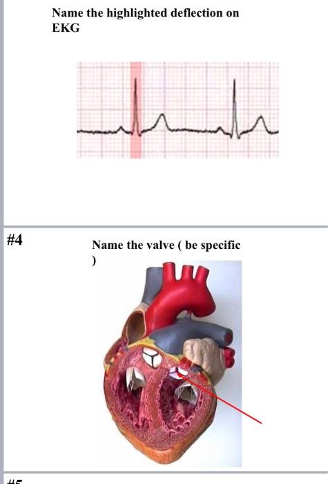 Solved #1 What is the line encircled? #2 Name the string | Chegg.com