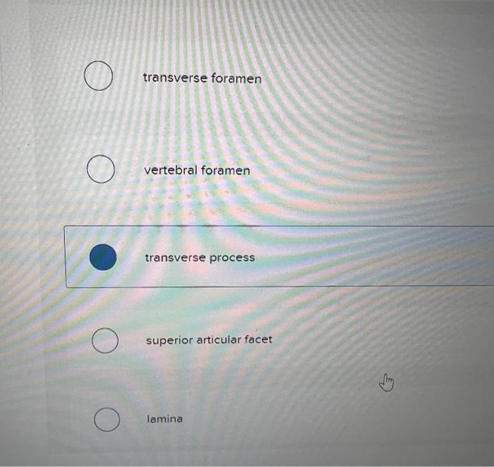 Solved Which structure is highlighted? body spinous process | Chegg.com
