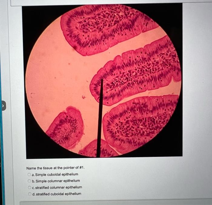 Solved Name the tissue at the pointer of \#1. a. Simple | Chegg.com