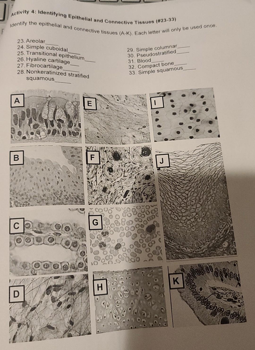 Solved Activity 4: Identifying Epithelial and Connective | Chegg.com