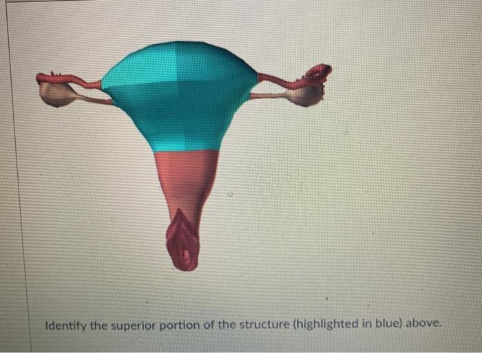 Solved Identify the superior portion of the structure | Chegg.com