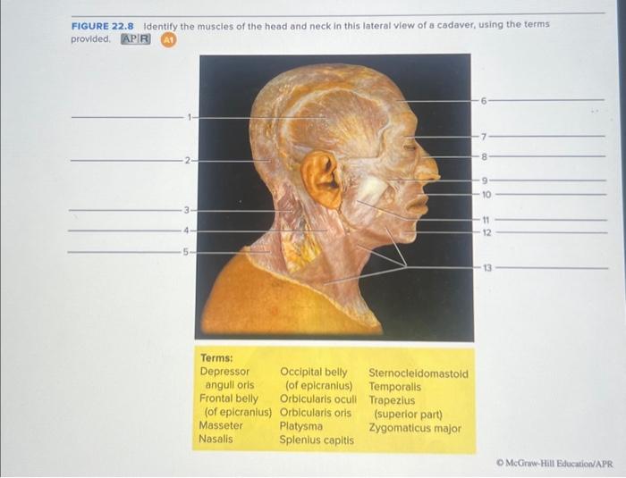 [Solved]: FIGURE 22.8 Identify the muscles of the head and n