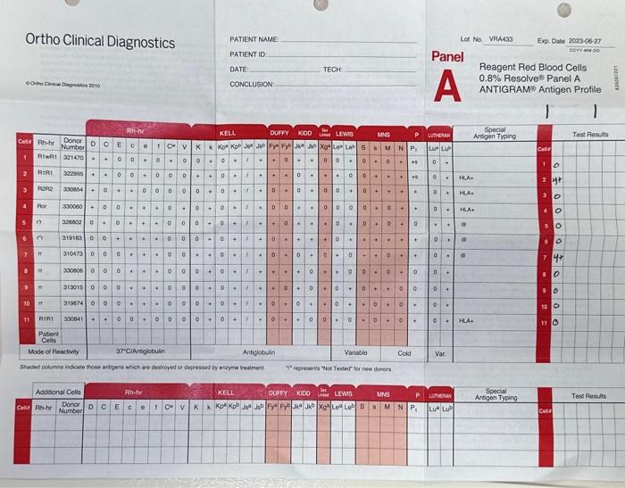 identify the red cell antigens after rolling out ? | Chegg.com