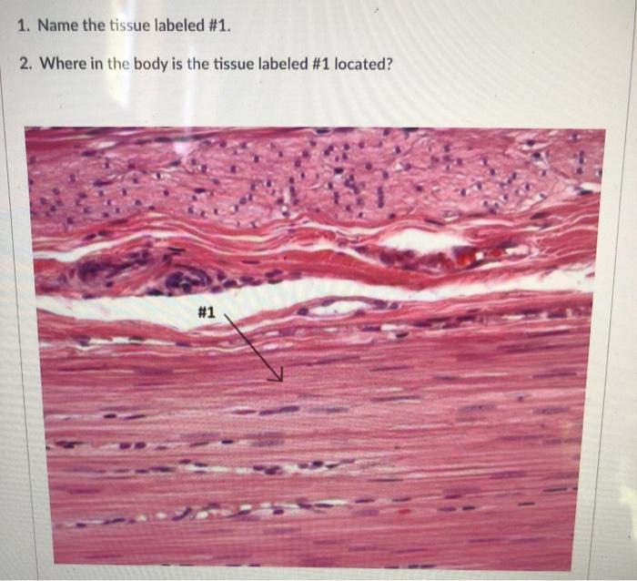 Solved 1. Name the tissue labeled #1. 2. Where in the body | Chegg.com