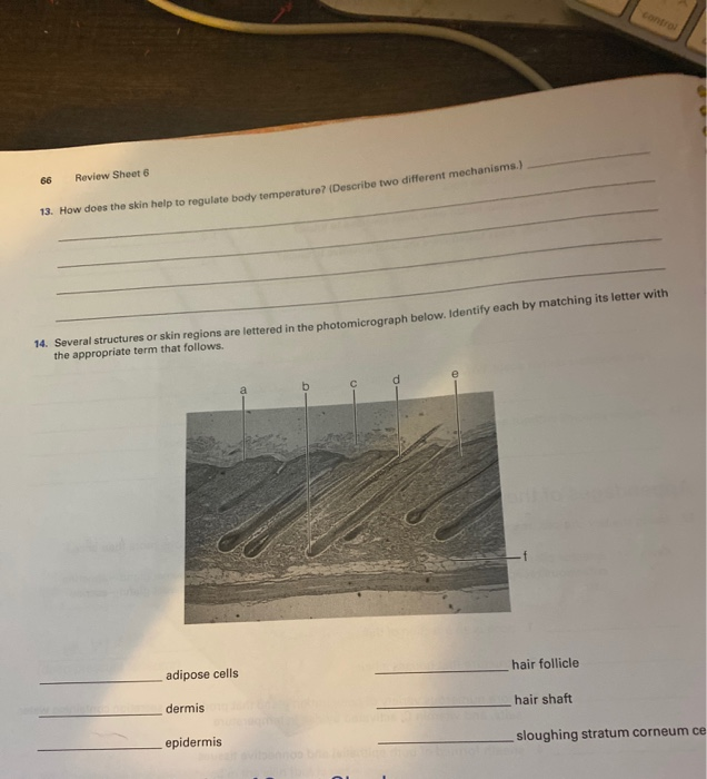 Solved 66 Review Sheet 6 13. How does the skin help to | Chegg.com