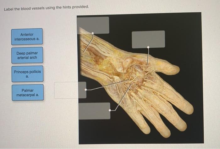 Solved Label the blood vessels using the hints provided. | Chegg.com