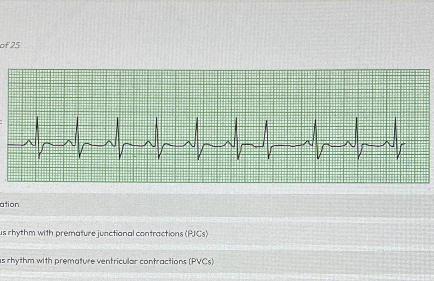 Solved of 25ationנs rhythm with premature junctional | Chegg.com