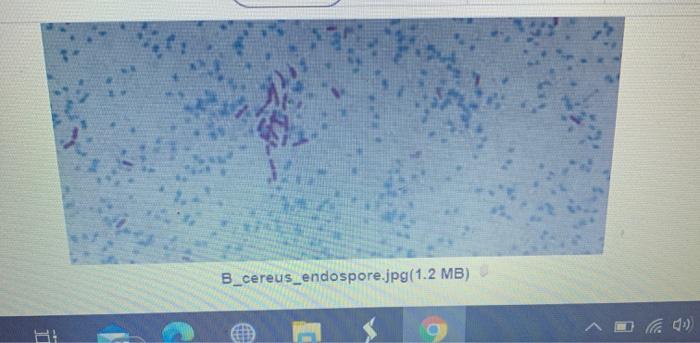 Solved Endospore slides: You will see the name of the | Chegg.com
