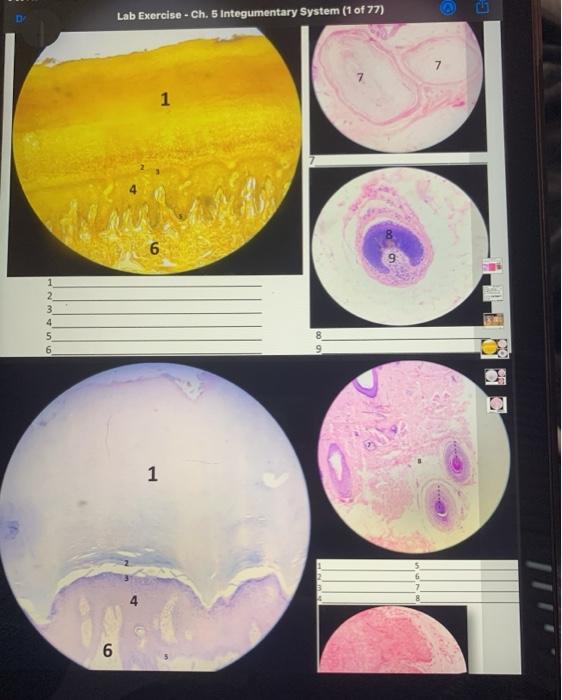 Solved DI Lab Exercise - Ch. 5 Integumentary System (1 of | Chegg.com