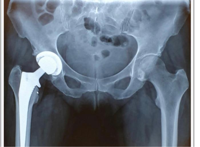 Solved Can someone label where the head of the femur, | Chegg.com