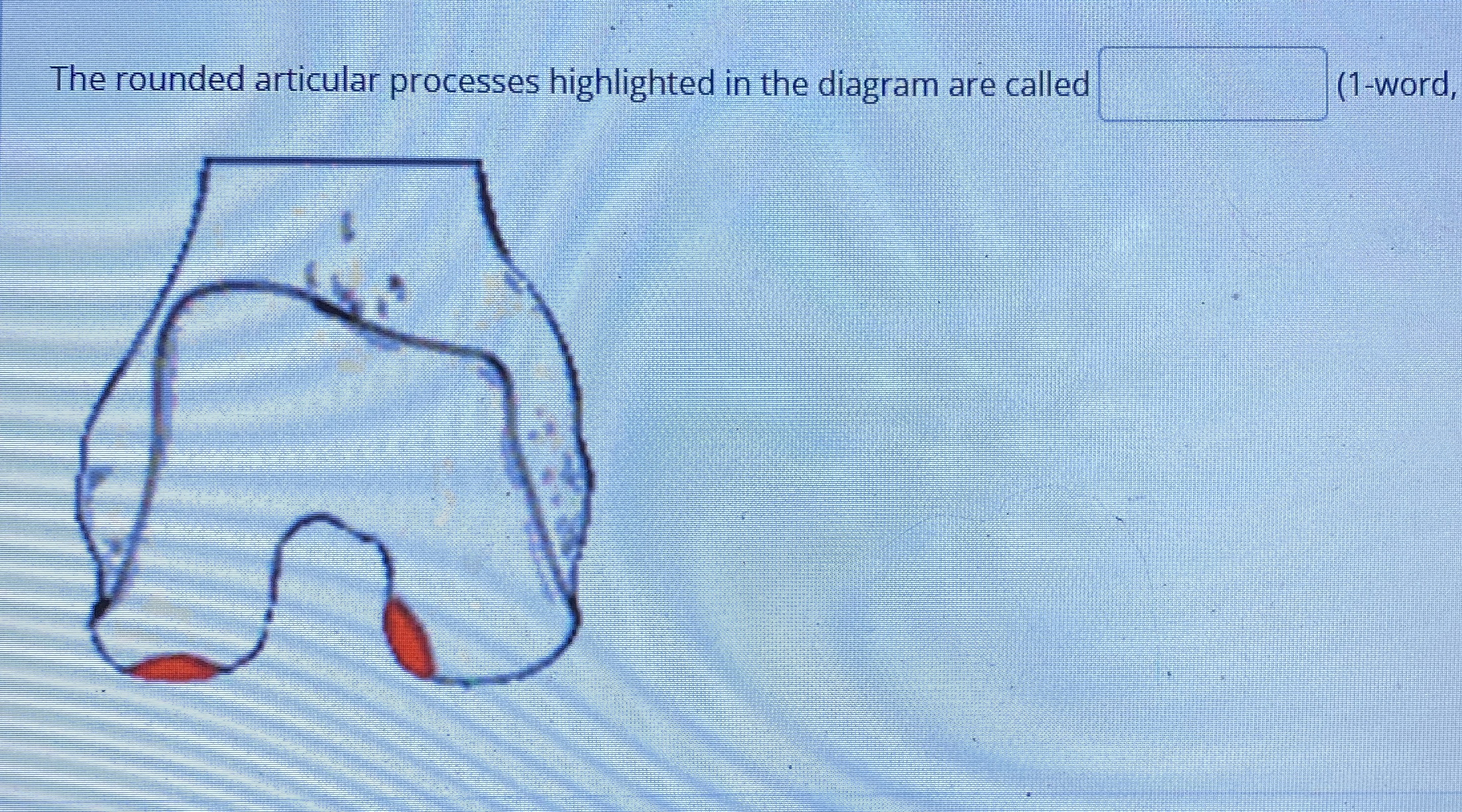 Solved The rounded articular processes highlighted in the | Chegg.com
