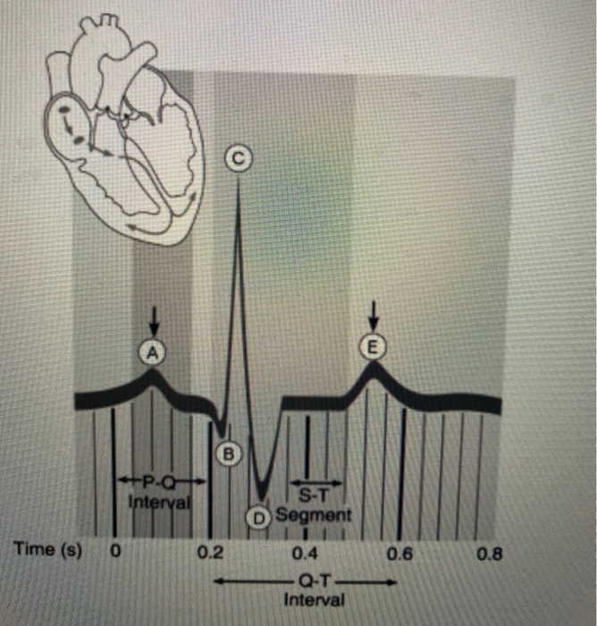 Solved E B В +P-Q Interval S-T O Segment Time (s) 0 0.2 0.4 | Chegg.com