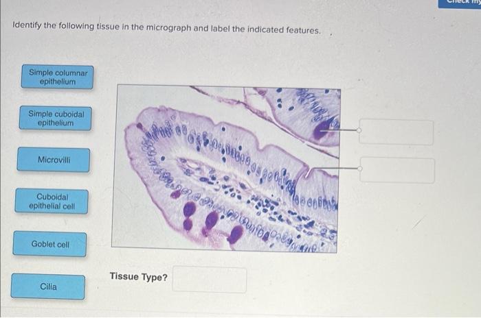 Identify the following tissue in the micrograph and | Chegg.com Identify the following tissue in the micrograph and | Chegg.com
