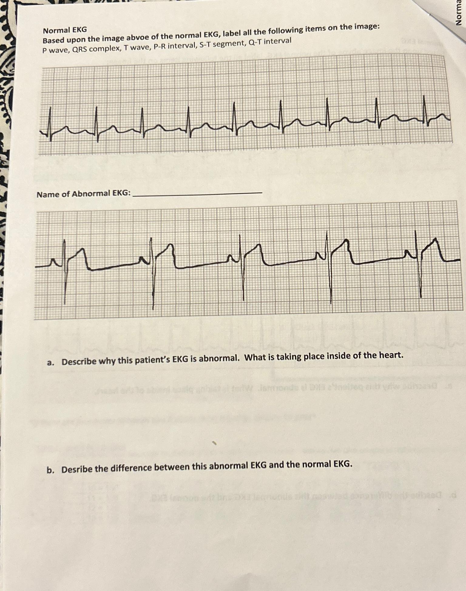 Solved Normal EKGBased upon the image abvoe of the normal | Chegg.com