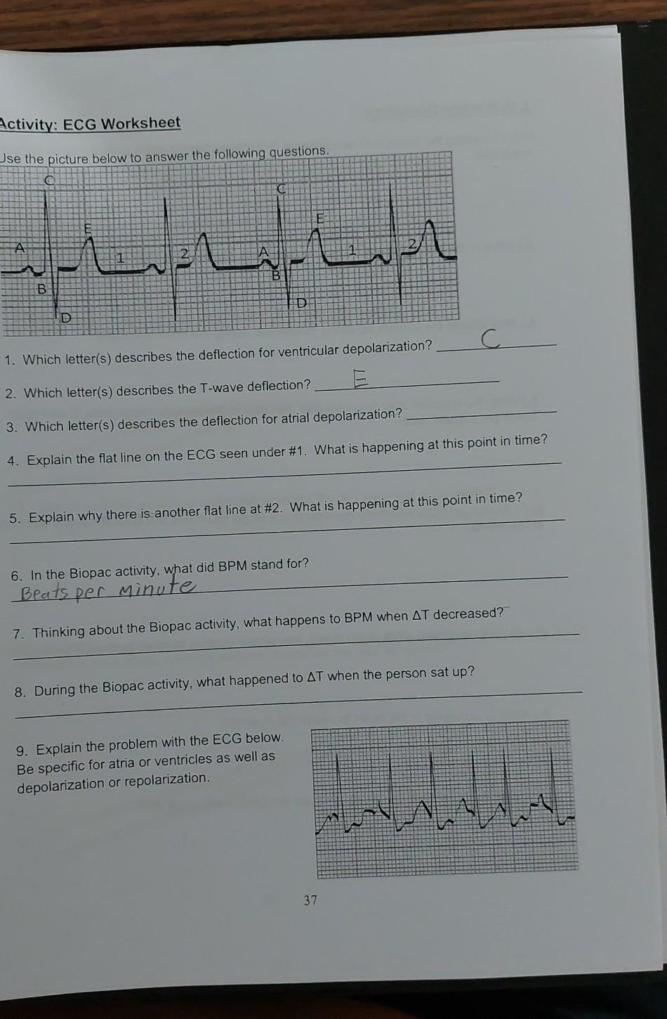 Solved Activity: ECG Worksheet Use the picture below to | Chegg.com