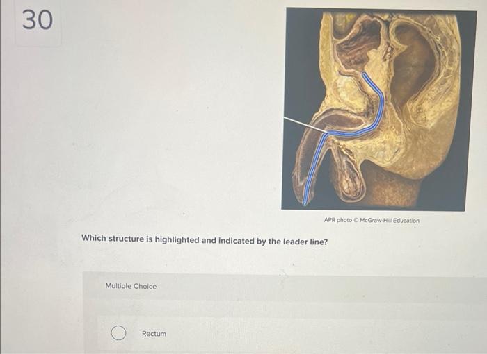 Solved APR phioto O McGraw Hal Education Which structure is | Chegg.com