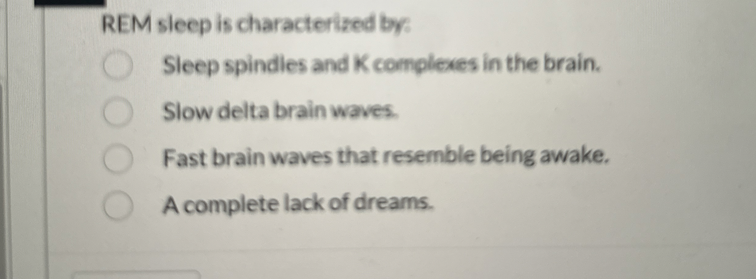 Solved REM sleep is characterised bySleep spindles and K | Chegg.com
