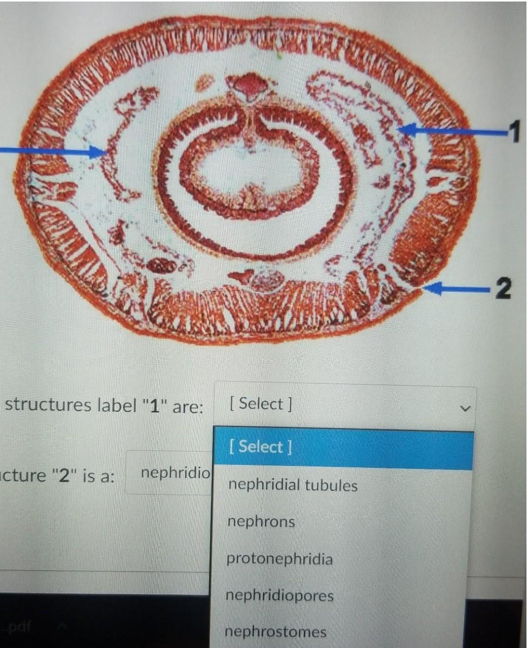 Solved DOWN 1 2 structures label "1" are: [ Select ] [ | Chegg.com